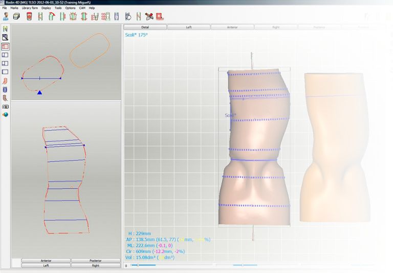 SISTEMA CAD-CAM – GOSS